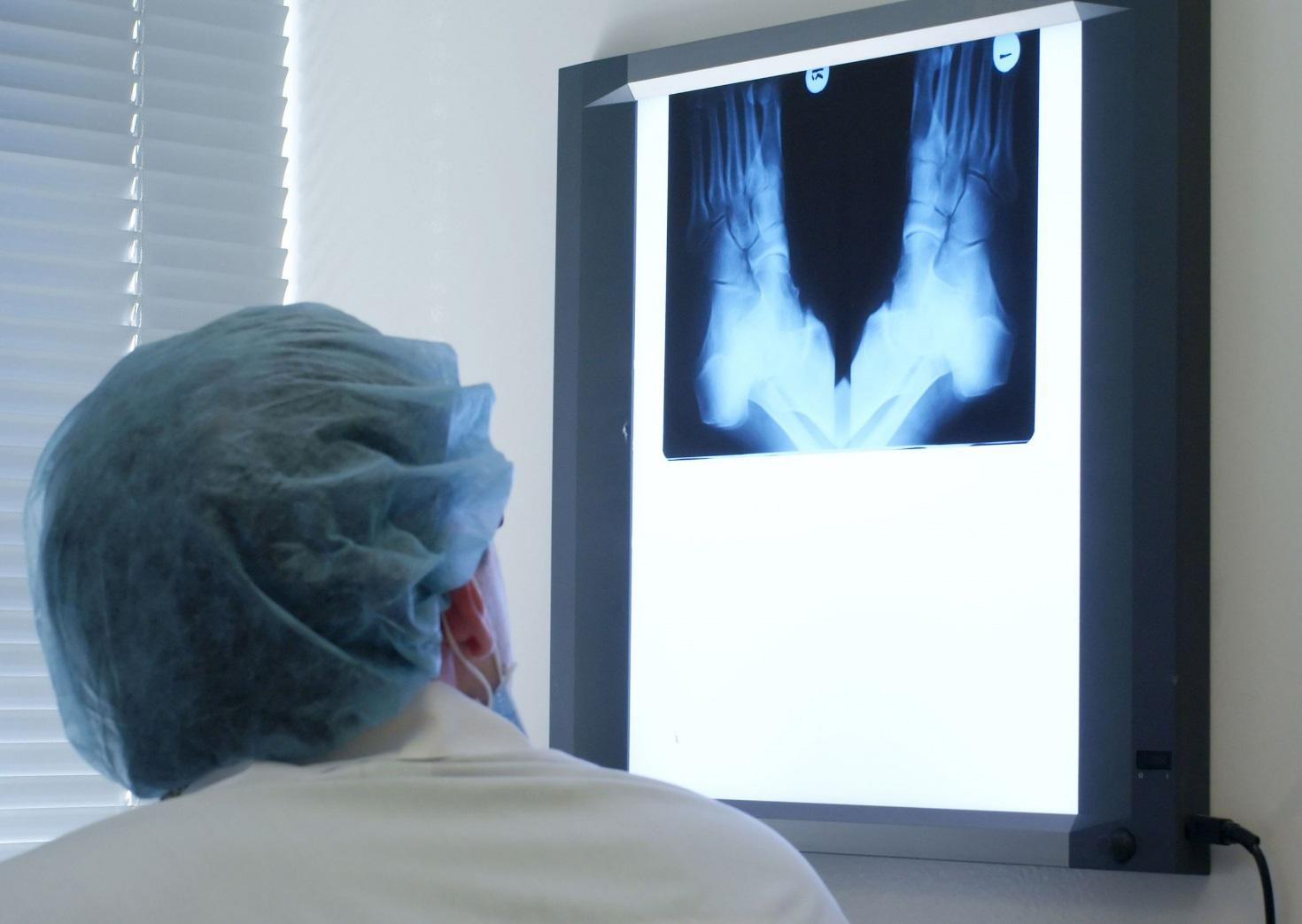 Rx Piede cosa è, cosa si vede e quando farla