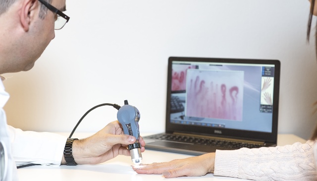 Capillaroscopia cosa è, cosa si vede e quando farla