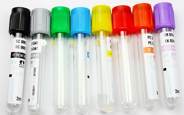 Emocromo Con Formula cosa è, cosa si vede e quando farla